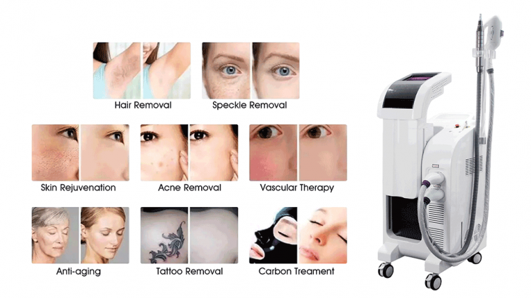 IPL Beauty Machine: The Ultimate Solution for Perfect Skin